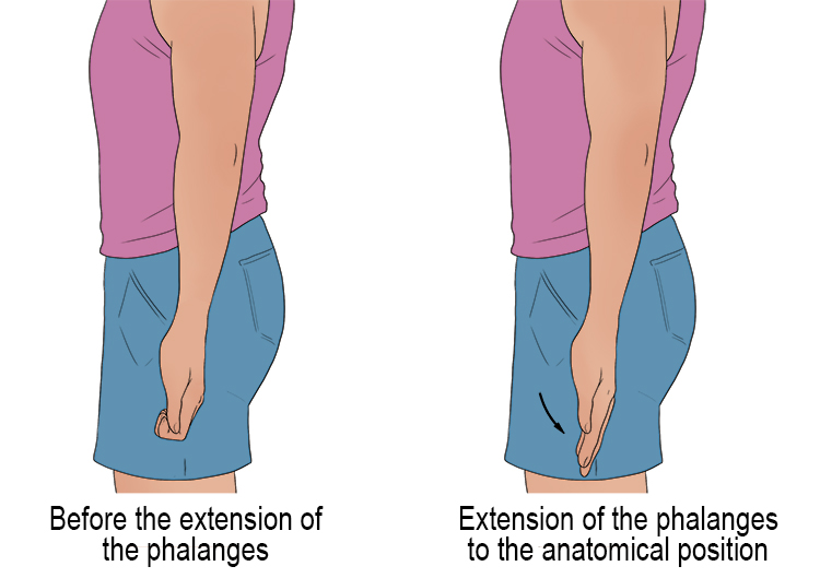 Extension Increases The Angle Of Bones at William Jennings blog